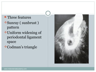Malignant Tumors of Connective Tissue-II /orthodontic courses by Indian ...