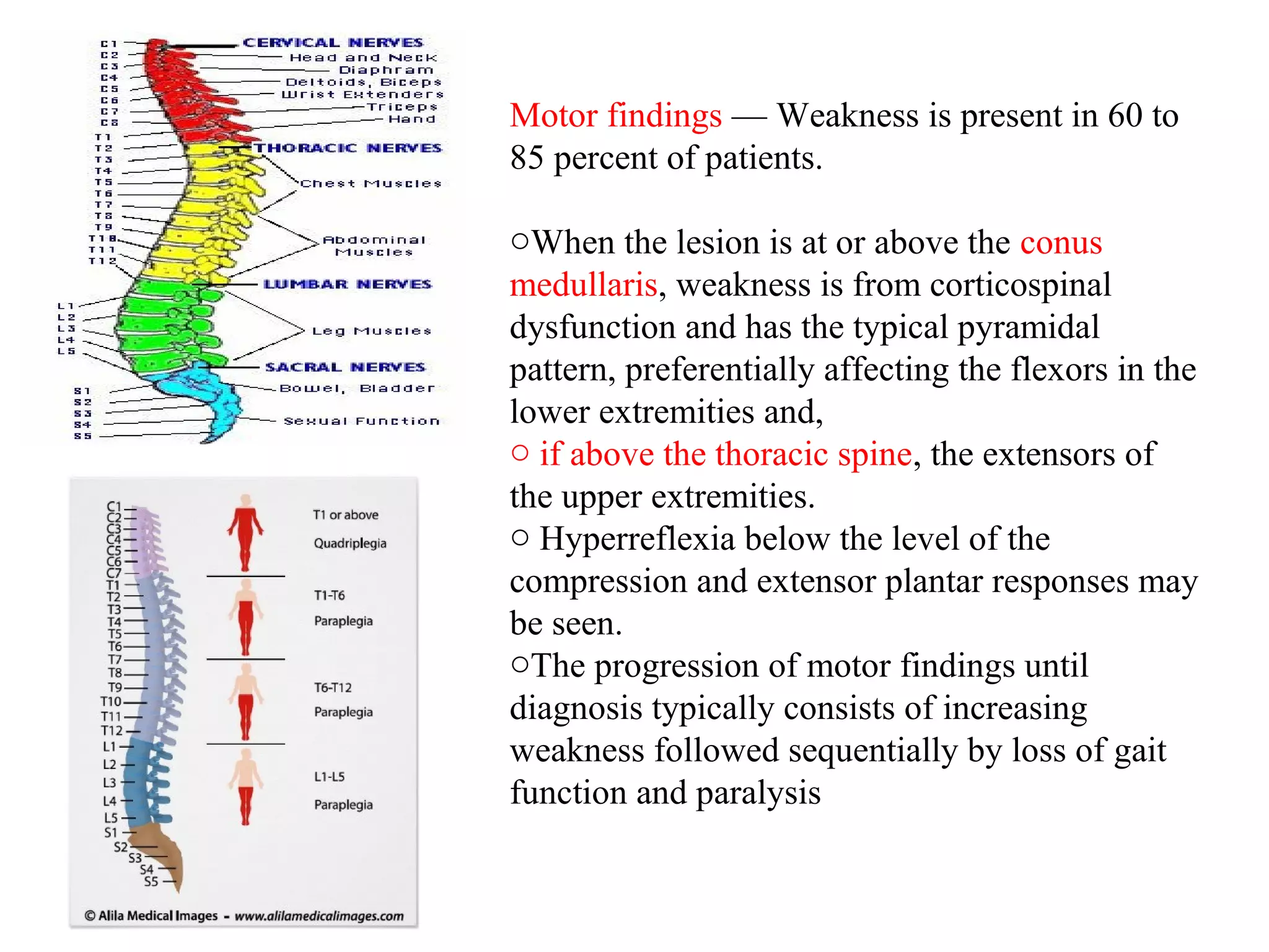 Maliganant spinal cord compression main | PPT
