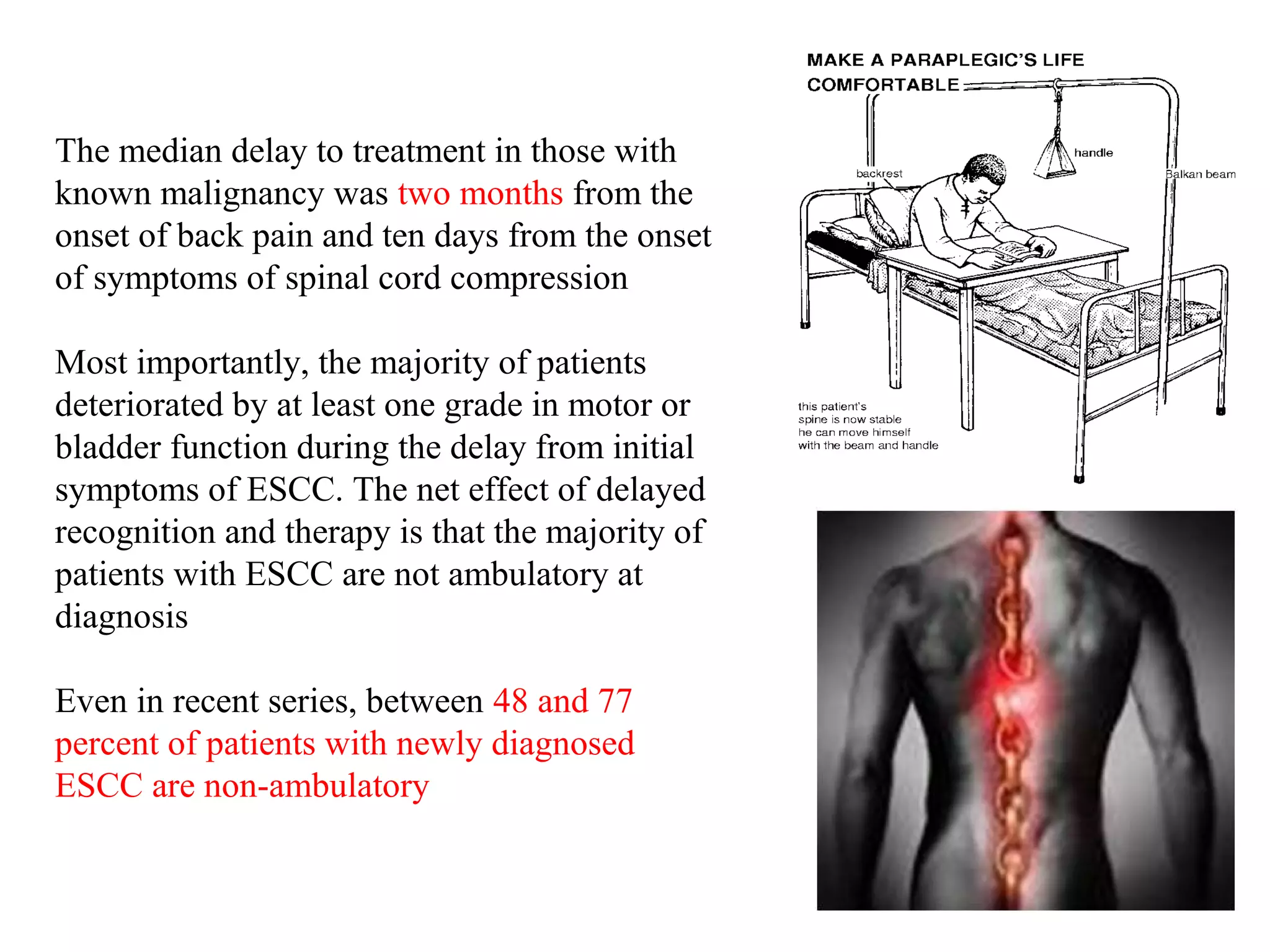 Maliganant spinal cord compression main | PPT