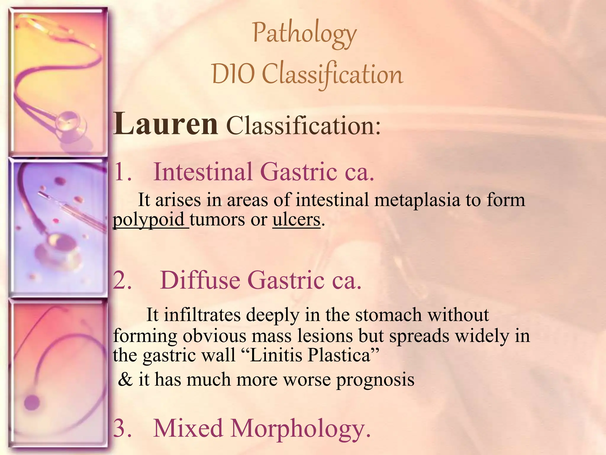 Benign & Malignant Tumors of the Stomach | PPTX