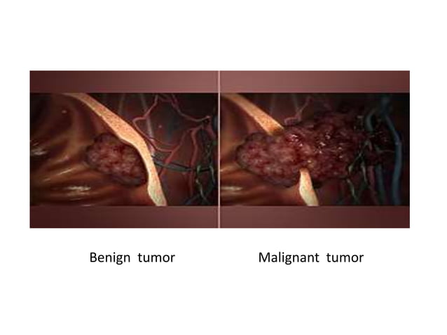 MALIGNANCY & MGT OF CARCINOMA PATIENTS.pptx