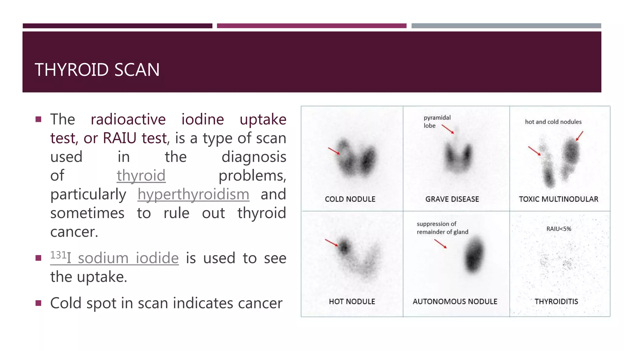 Malignant bone tumor | PPTX
