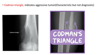 Malignant bone tumors | PDF | Bone and Joint Conditions | Diseases and ...