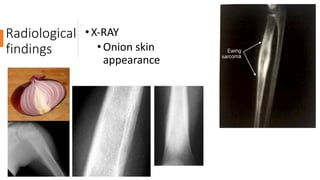 Malignant bone tumors | PDF | Bone and Joint Conditions | Diseases and ...