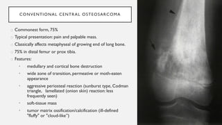 Radiology Malignant bone tumors | PDF