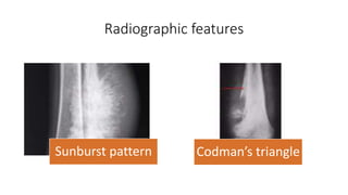 Malignant bone tumors (Nutshell) | PPTX