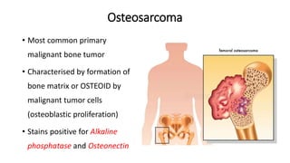 Malignant bone tumors (Nutshell) | PPT