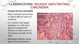 MALIGNANT BREAST LESIONS.pptx