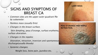 MALIGNANT BREAST LESIONS.pptx