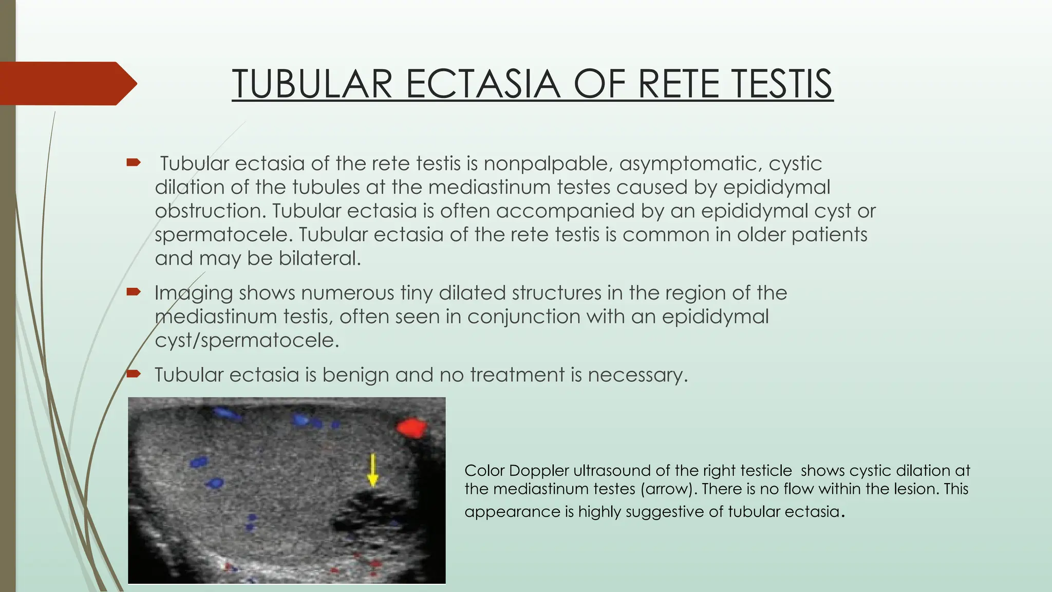malignant diseases of uterus and vagina.pptx