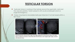 malignant diseases of uterus and vagina.pptx