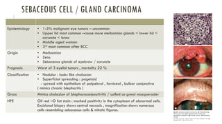 Malignant Eyelid Tumors presentation 2024 | PPTX