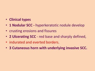 Malignant eyelid tumours | PPTX
