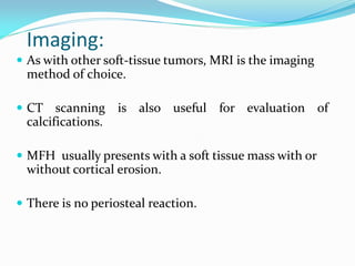 Malignant fibrous histiocytoma, Undifferntiated pleomorphic sarcoma | PDF