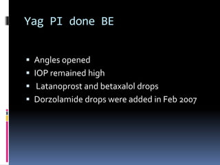 Malignant glaucoma | PPT