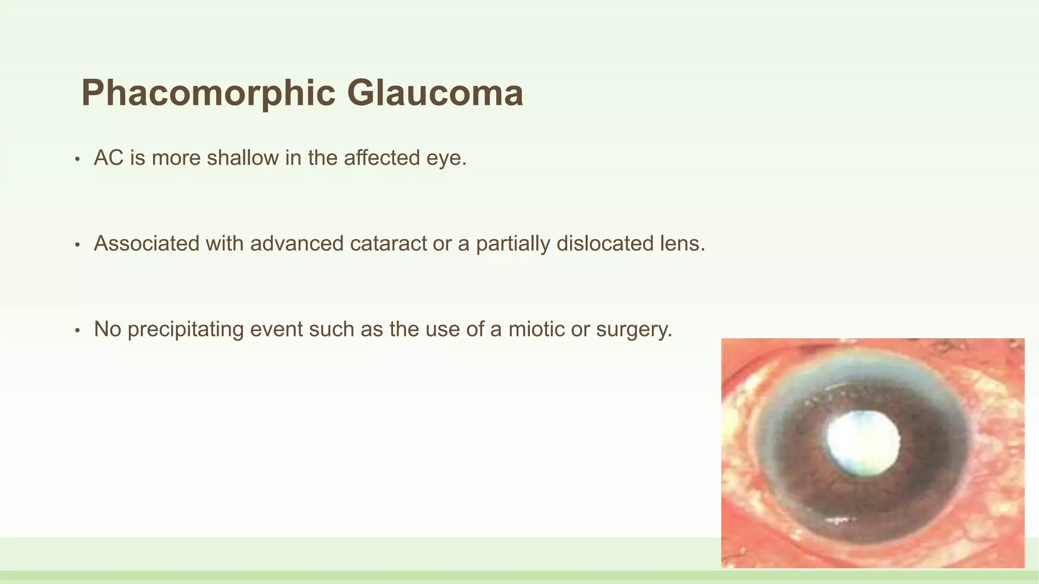 Malignant glaucoma - Dr Shylesh B Dabke | PPTX