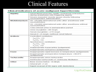 Malignant hyperthermia and dantrolene sodium | PPTX