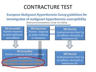 Malignant hyperthermia [final] | PPTX