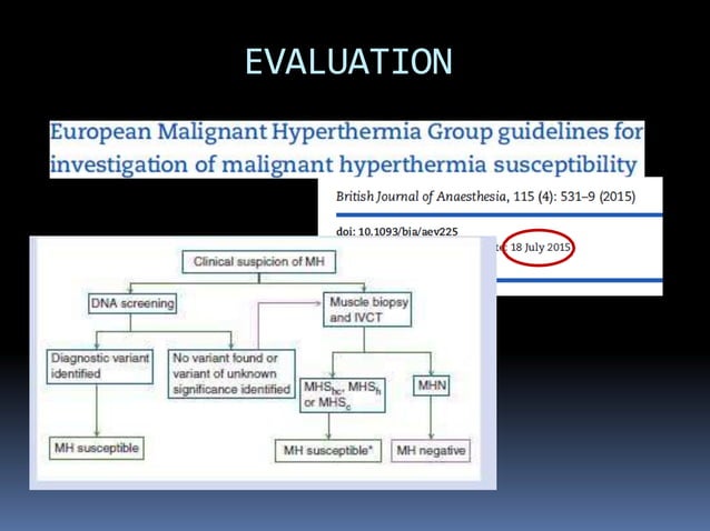 Malignanthyperthermiafinal and anaesthetic consideration | PPTX