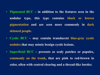 malignant epithelial tumors of oral cavity | PPTX