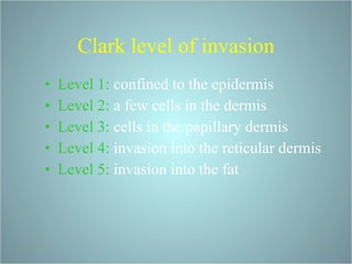 Malignant Melanoma | PPT