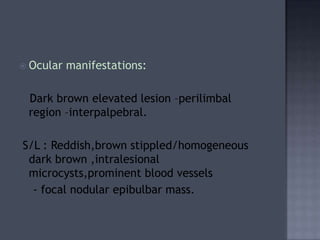 Malignant melanoma | PPT