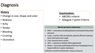 Malignant melanoma | PPTX | Cancer | Diseases and Conditions