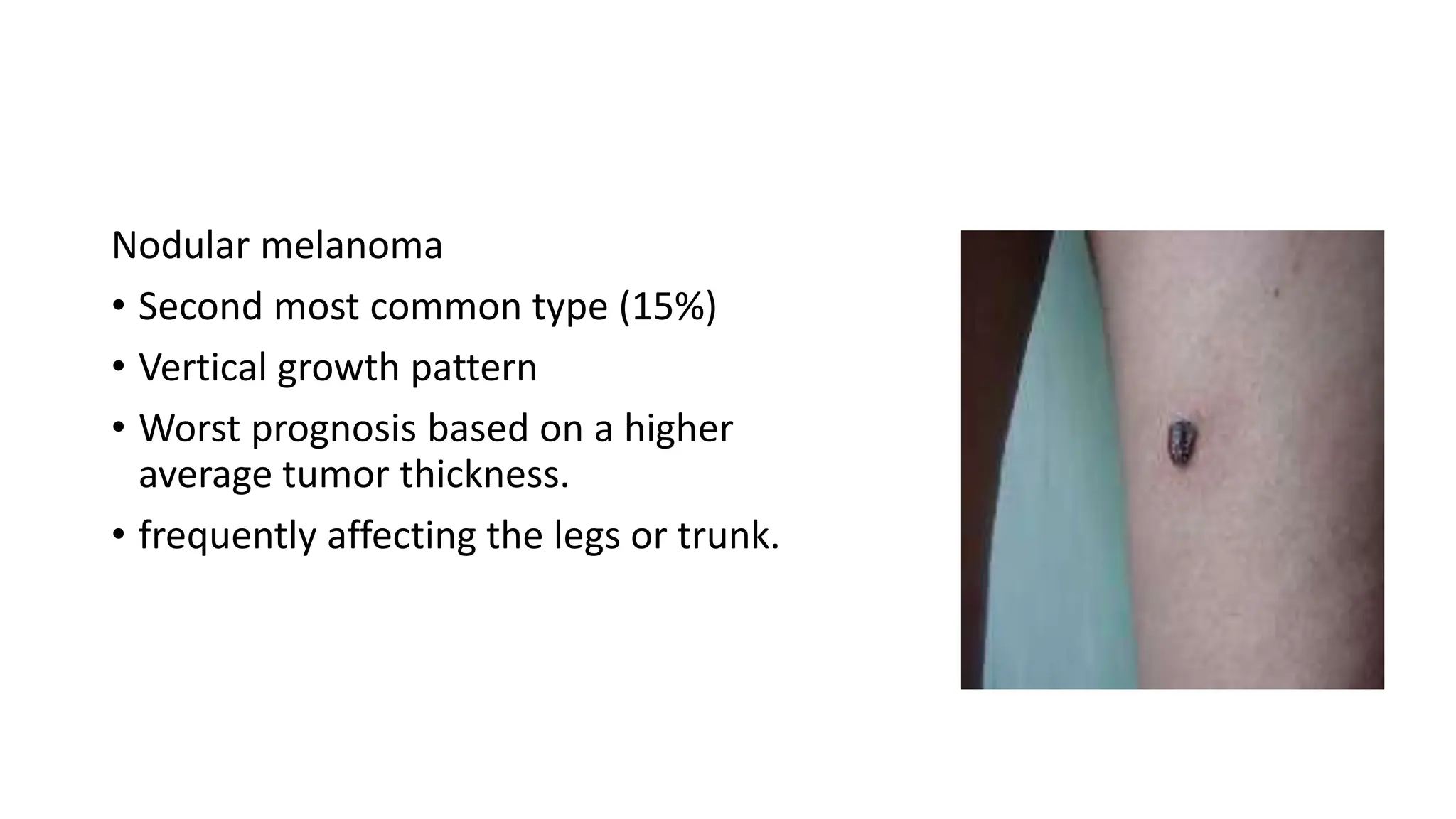 Malignant Melanoma.pptx