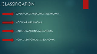 MALIGNANT MELANOMA (1).pptx . | PPTX