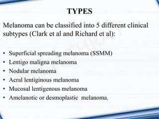 Malignant melanoma Dr chithra p | PPT