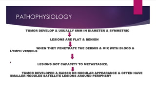 MALIGNANT MELANOMA skin cancer integumentary system | PPTX