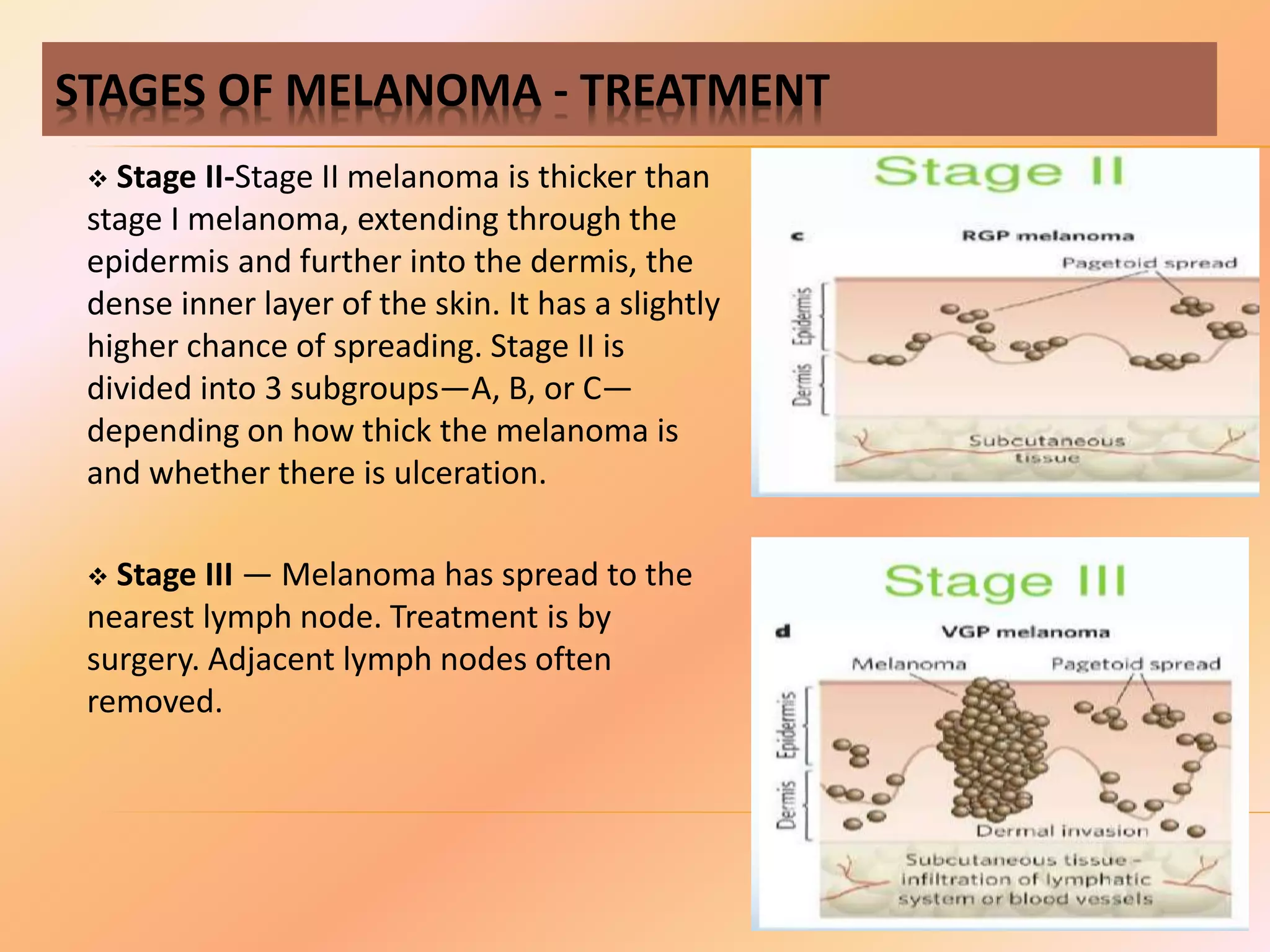 Malignant melanoma | PPTX