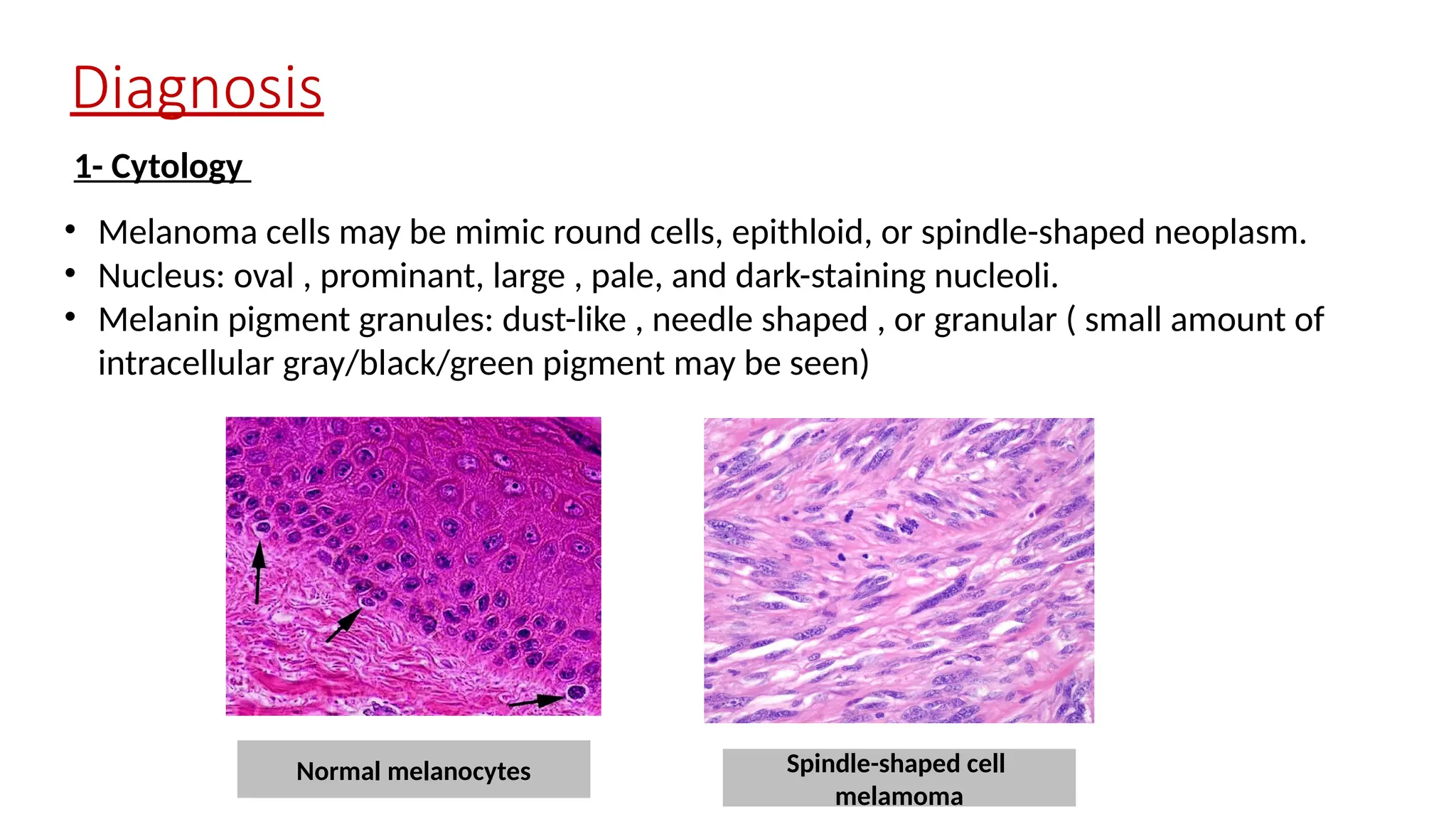 Malignant melanoma in dogs: diagnosis and treatment | PPTX