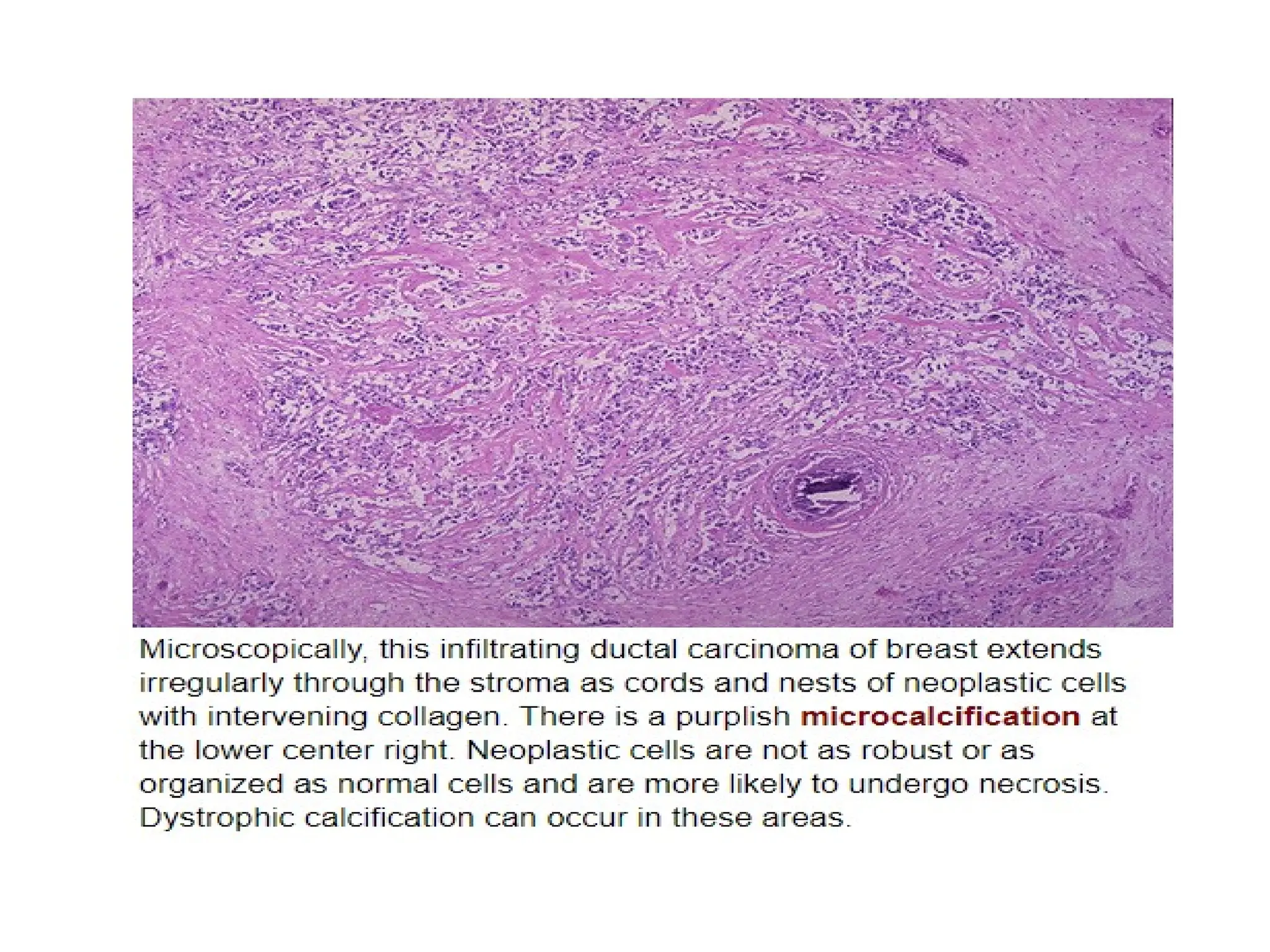 MALIGNANT NEOPLASIA.pptx FOR BPT BY DR. ANUBHA MA'AM | PPTX