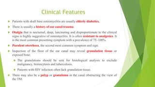 Malignant Otitis Externa.pptx