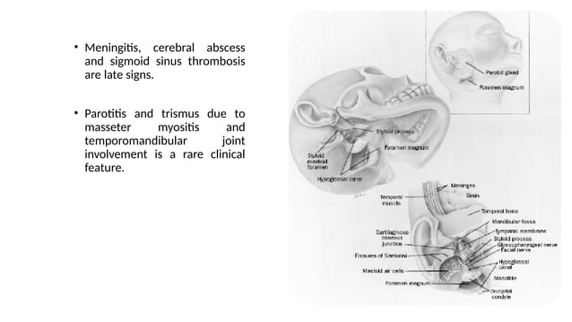 malignant otitis externa diseases of external ear | PPTX