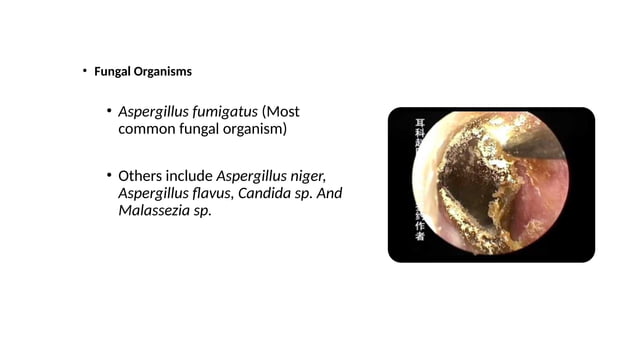 malignant otitis externa diseases of external ear | PPTX