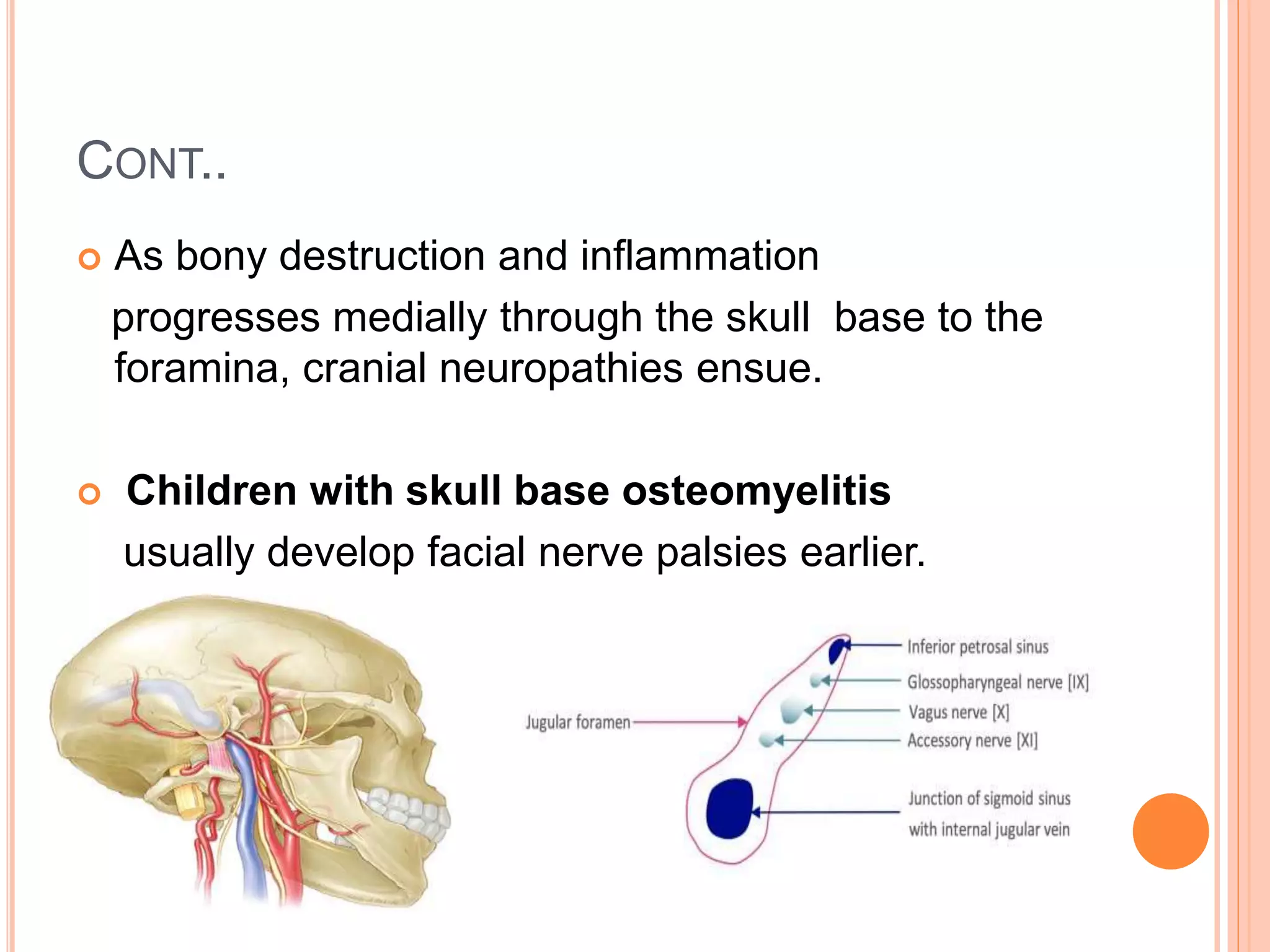 Malignant otitis externa clinical features and management | PPTX