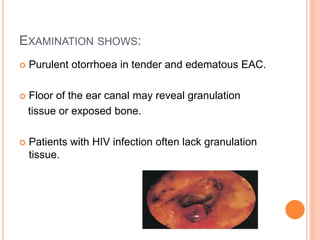 Malignant otitis externa clinical features and management | PPTX