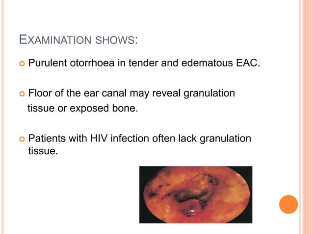Malignant otitis externa clinical features and management | PPTX