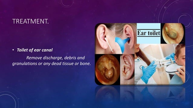 Malignant Otitis Externa by Dr.S .pptx