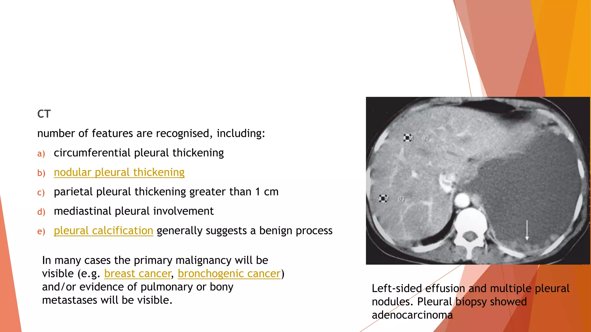 Malignant pleural effusions | PPTX