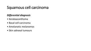 Malignant skin diseases | PPTX