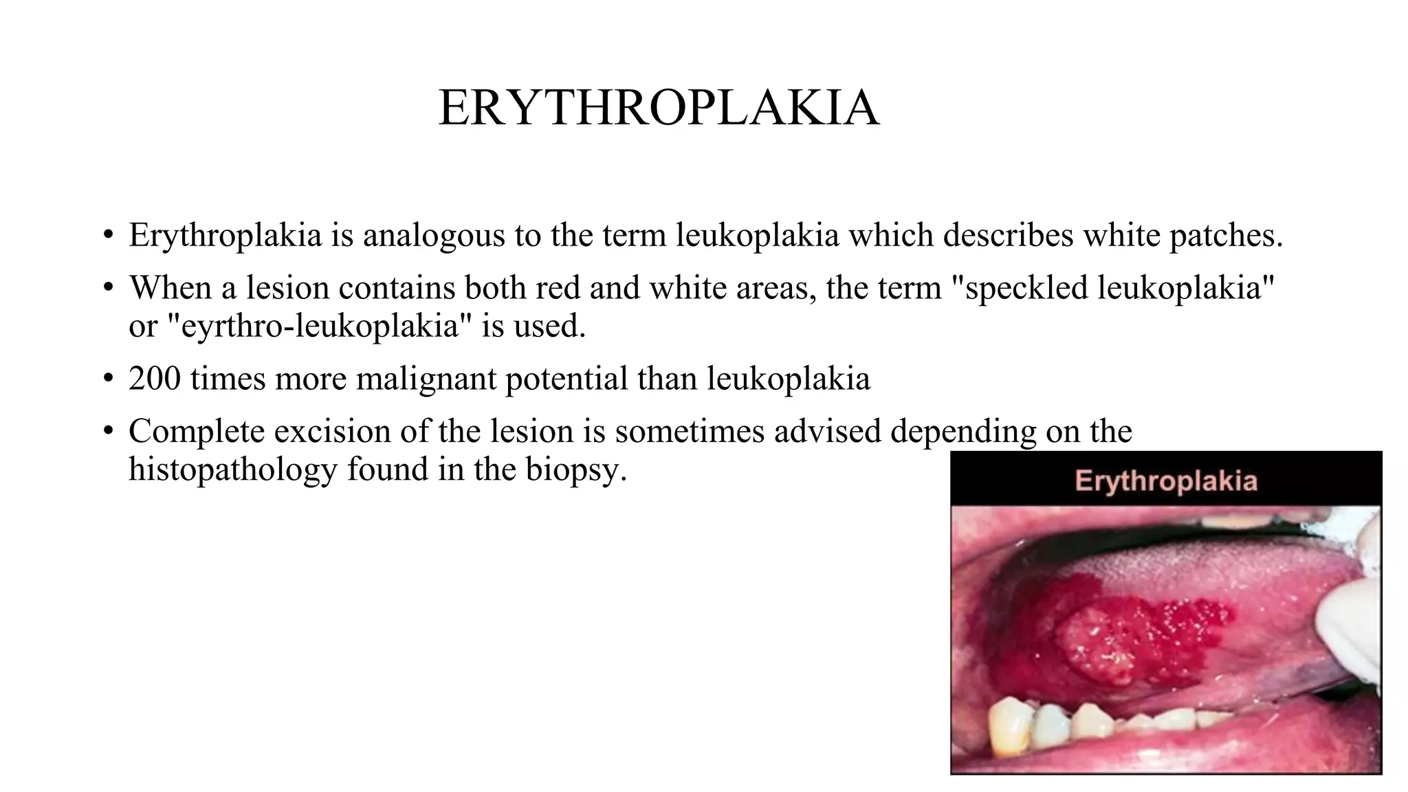 Malignant skin lesions | PPTX