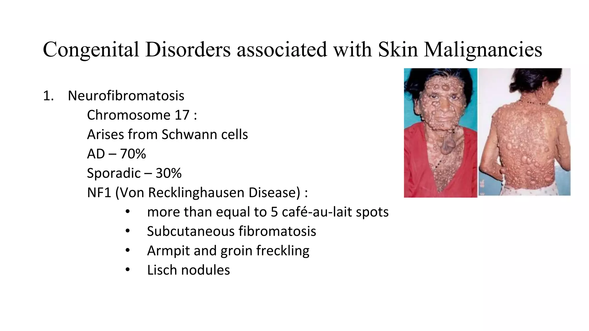 Malignant skin lesions | PPTX | Skin and Dermatology | Diseases and ...