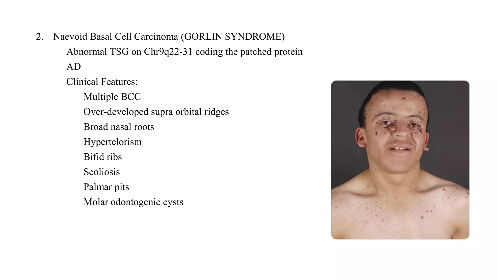 Malignant skin lesions | PPTX