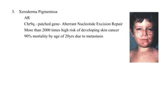 Malignant skin lesions | PPTX