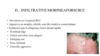 Malignant skin lesions | PPTX