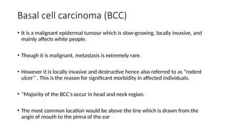 Malignant skin tumors .pptx