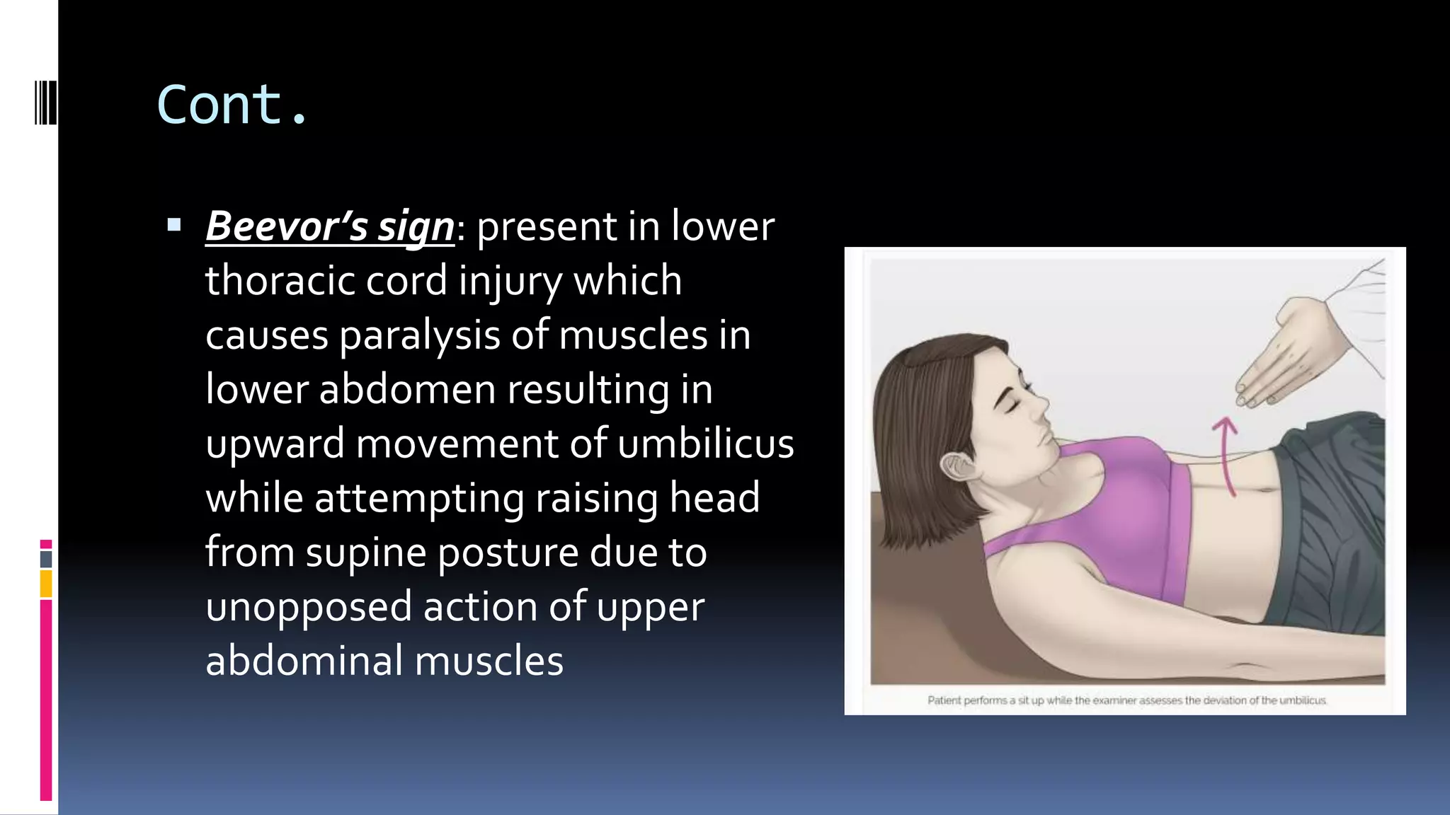 Malignant spinal cord compression | PPTX